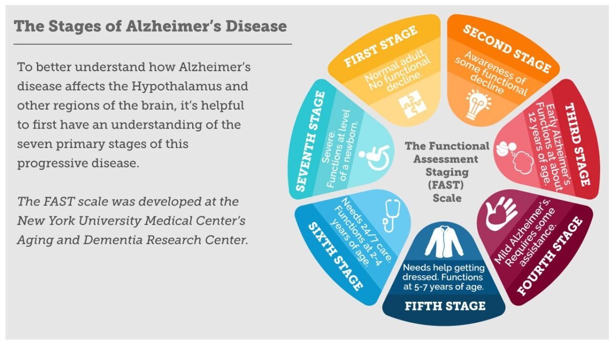 Understanding the Different Stages of Dementia